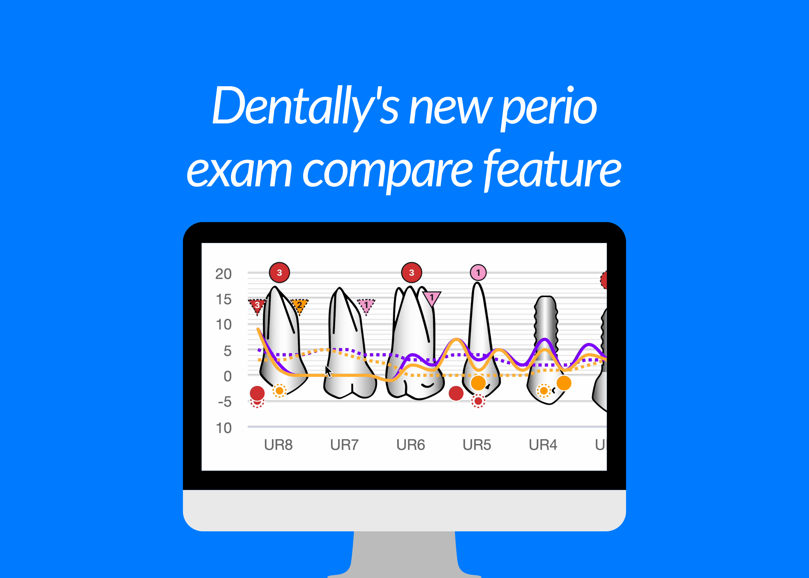 Comparing Exams on Dentally’s new Perio Exam – Part 2/3 Comparing Exams on Dentally’s new Perio Exam – Part 2/3